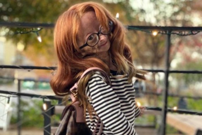 Adalia Rose, YouTube Star with Early-Aging Disorder, Dies at 15 - 92130 ...